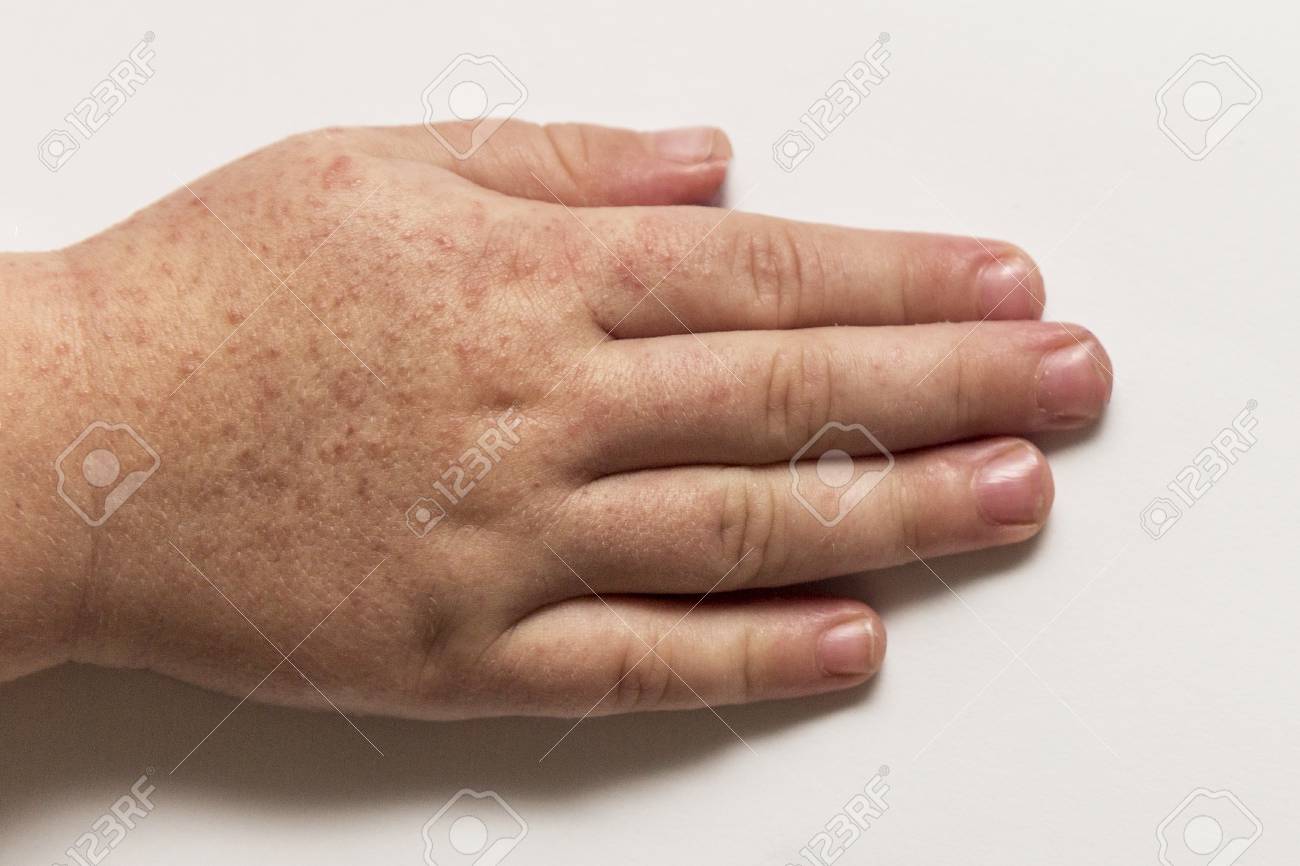 [37+] Contagious Backgrounds | WallpaperSafari