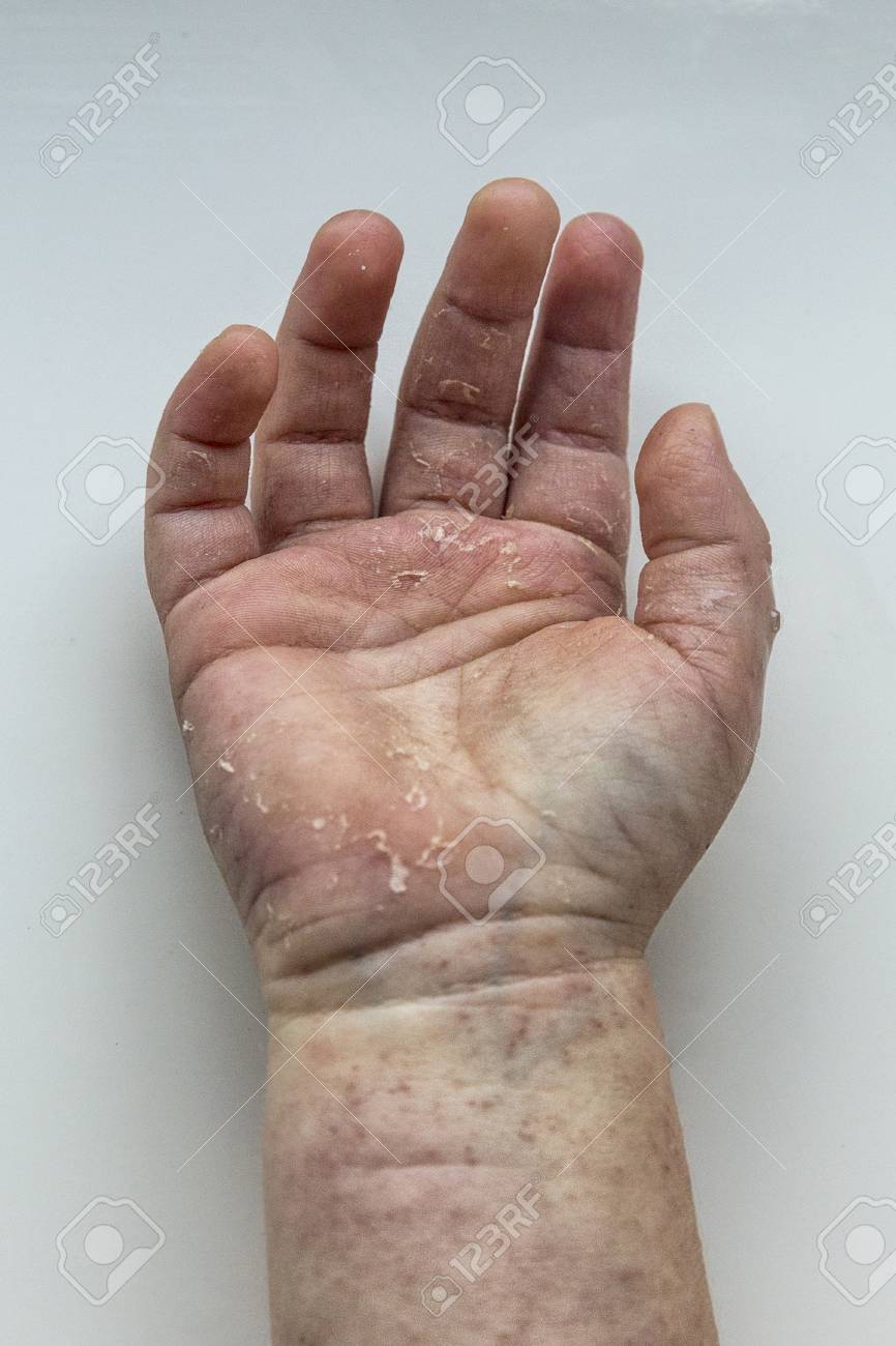 [37+] Contagious Background on WallpaperSafari