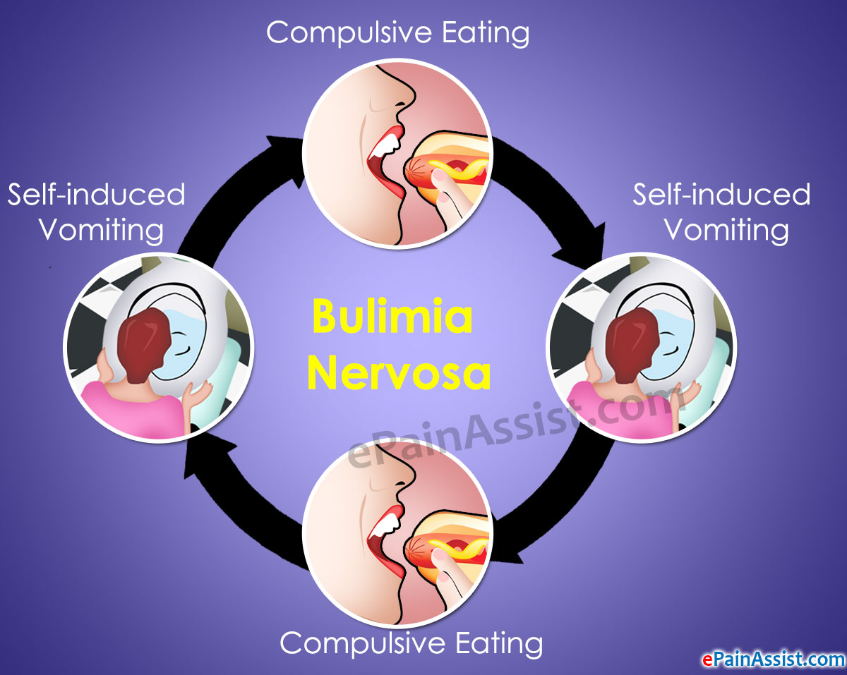 🔥 Free Download Bulimia Nervosa Recovery Steps And Tips To Cope With It ...