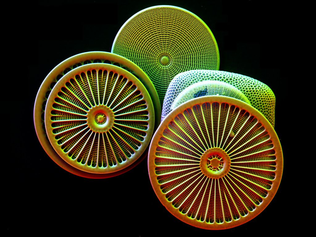 🔥 Free Download Diatoms Mostly Arachnoidiscus Microscopic Photography ...