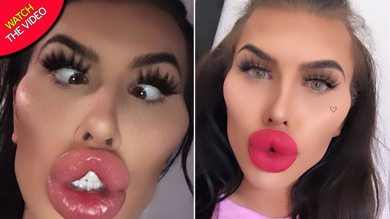 🔥 Free Download Woman With Uk S Biggest Lips Makes Each Month By by ...