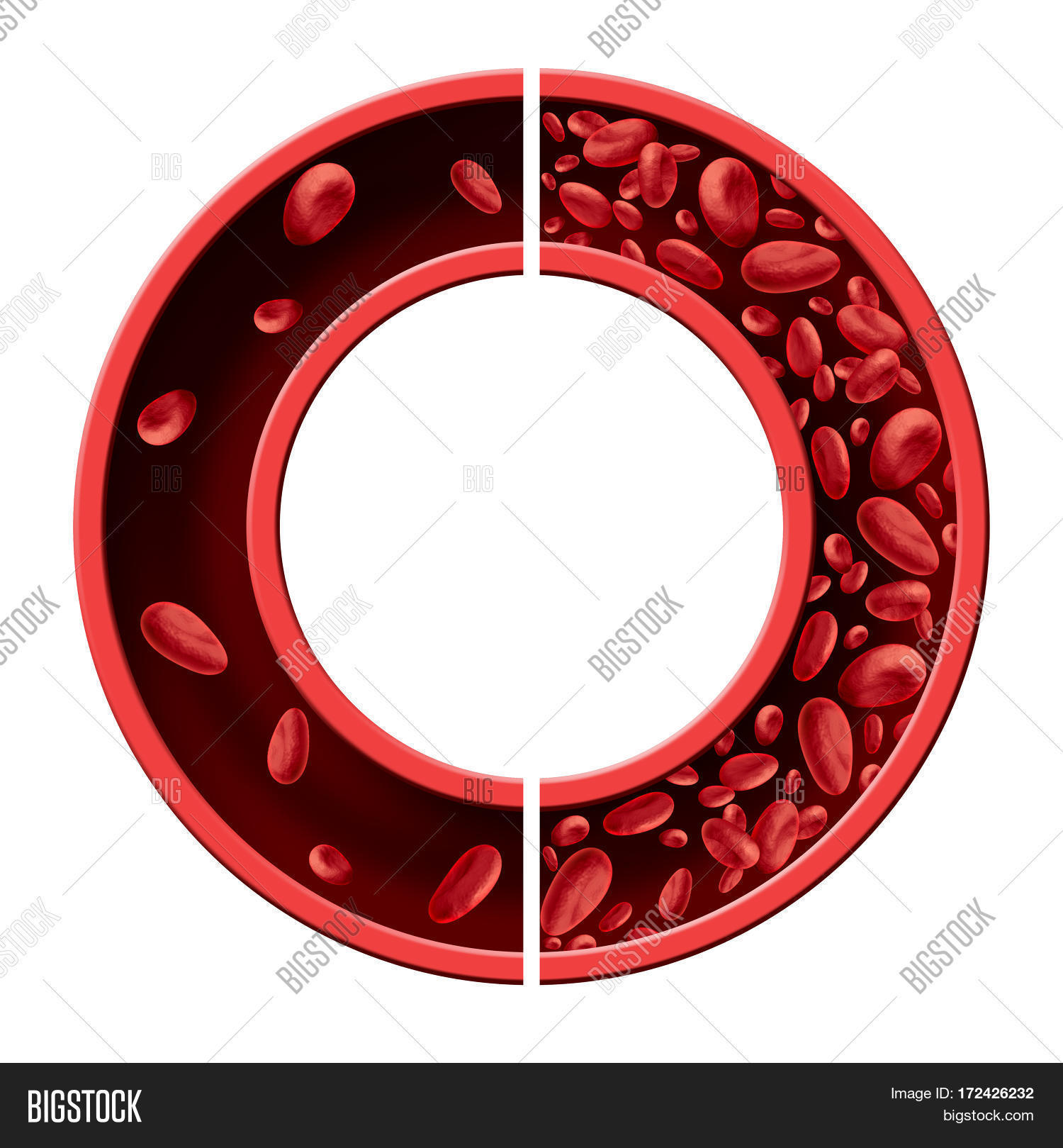 🔥 [41+] Anemia Backgrounds | WallpaperSafari