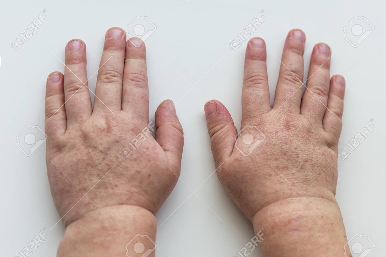 [37+] Contagious Background on WallpaperSafari